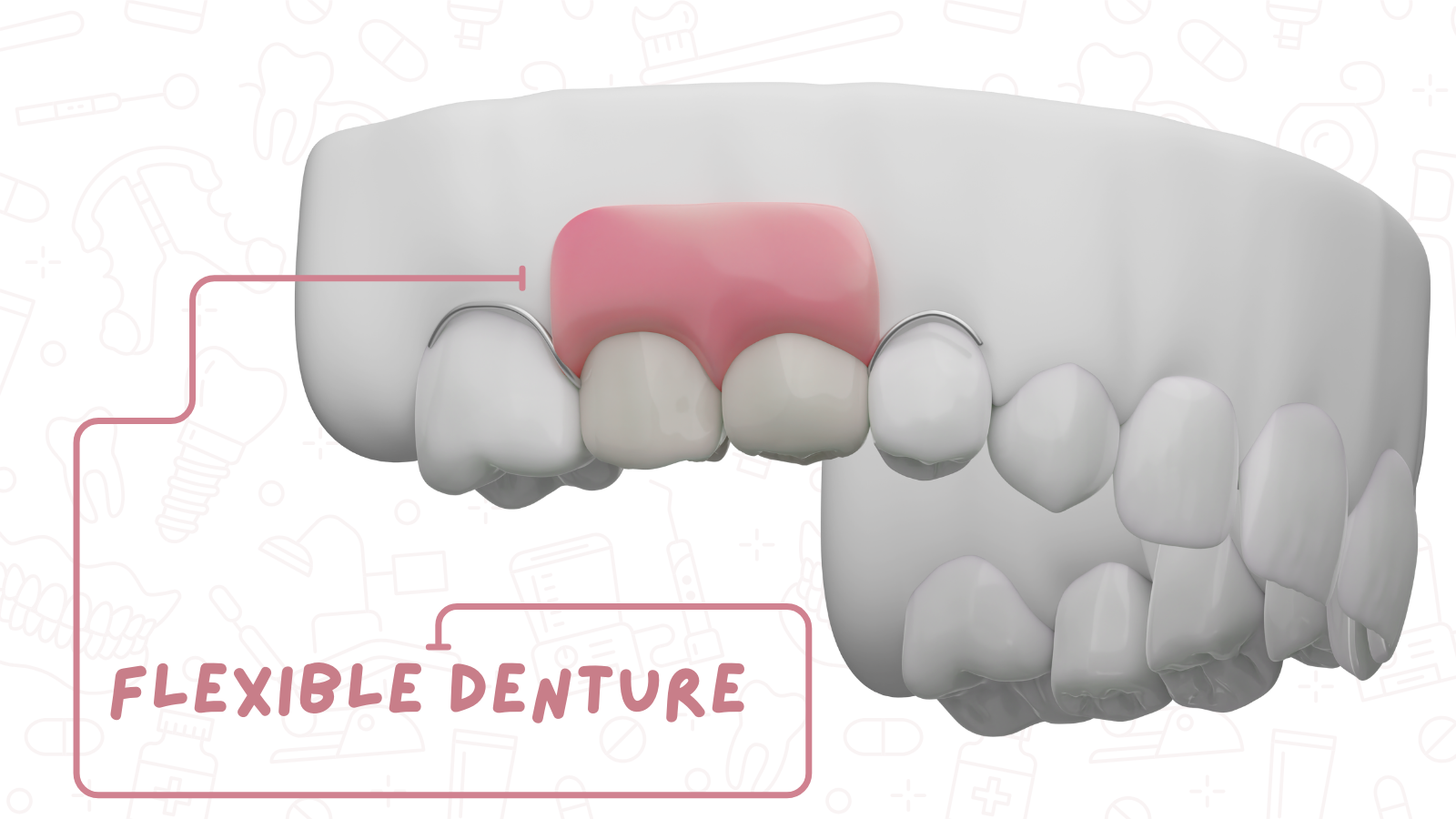 Flexible Dentures A Practical Solution for Modern Denture Wearers ...